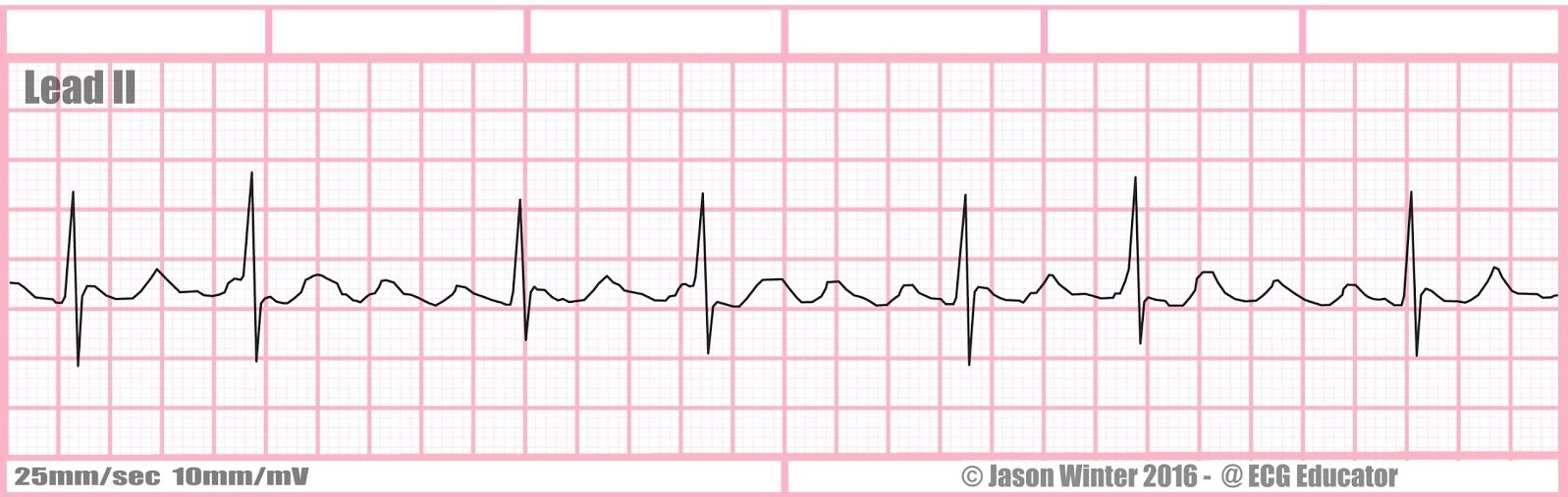 EKG Benchmark Review Jeopardy Template