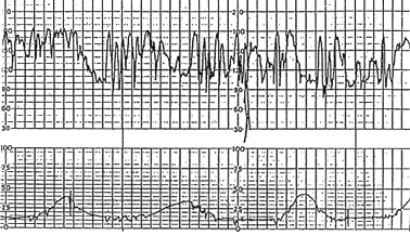 Fetal Monitoring Jeopardy Template