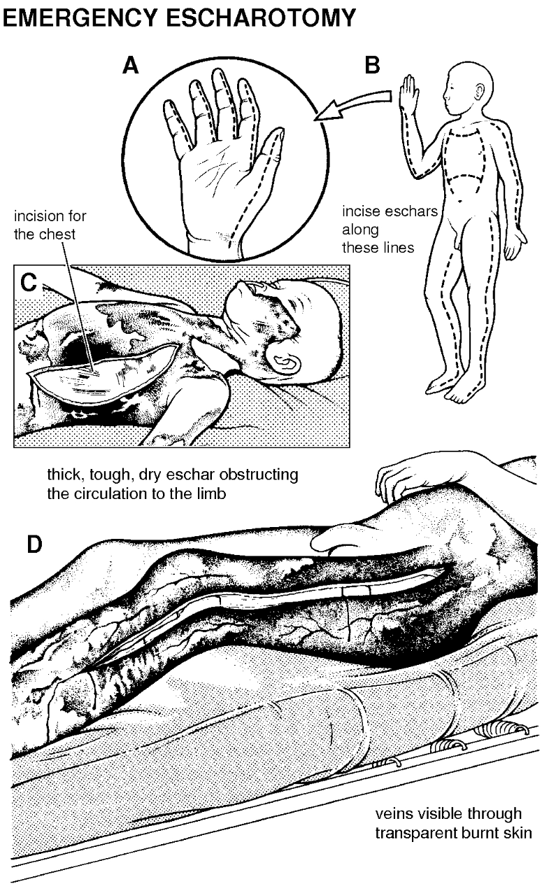 Trauma Jeopardy Template