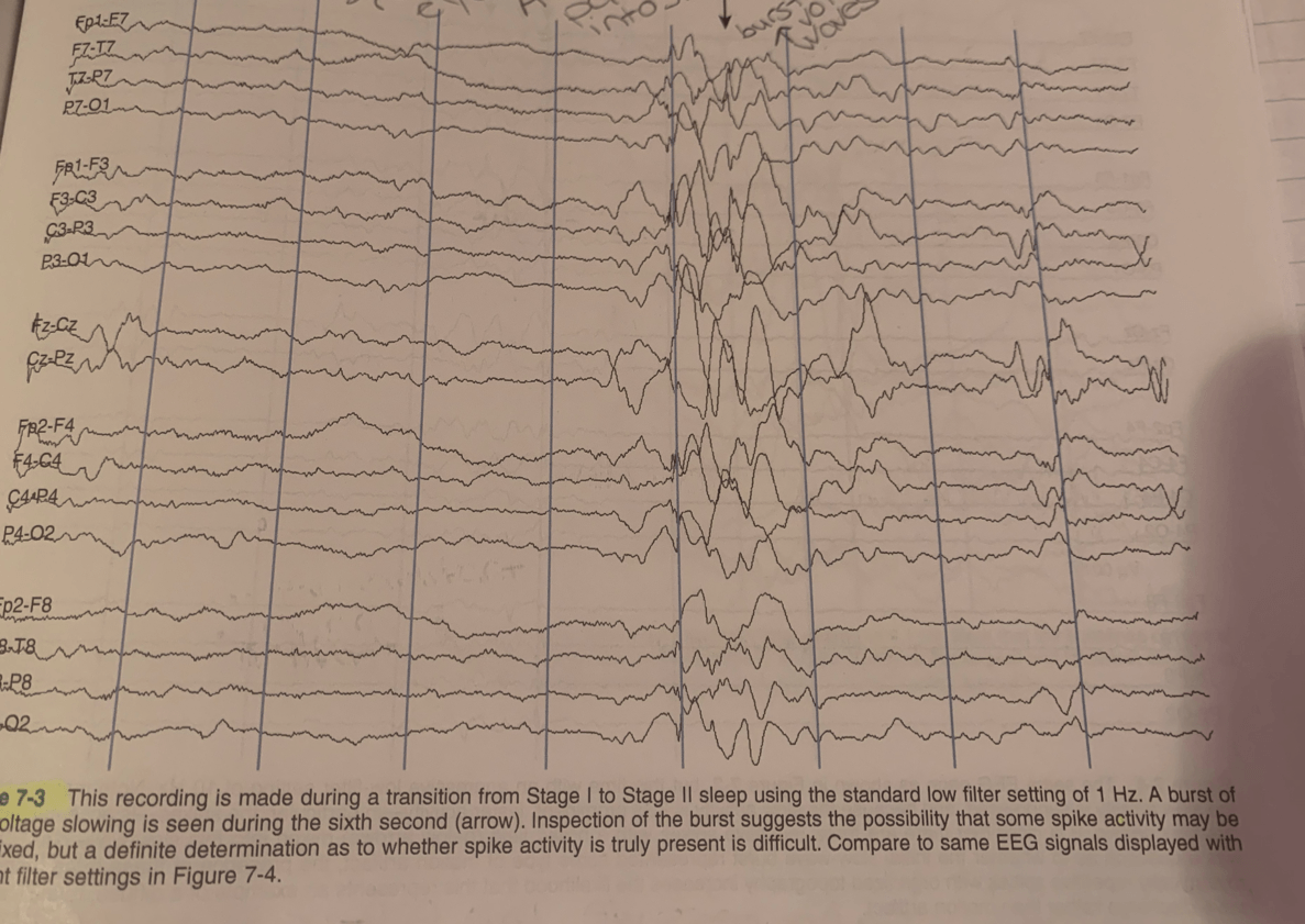 Filters in the Electroencephalogram Jeopardy Template
