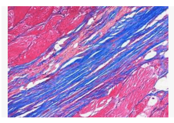 Enzyme Histochemistry