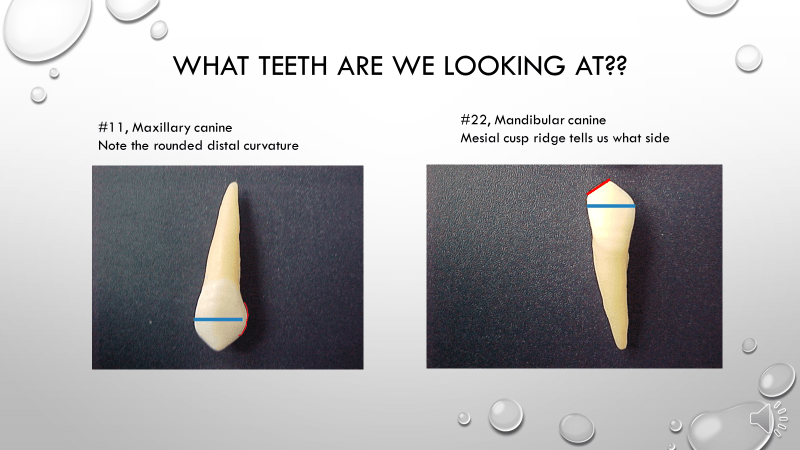 Dental Anatomy Final review 2 Jeopardy Template